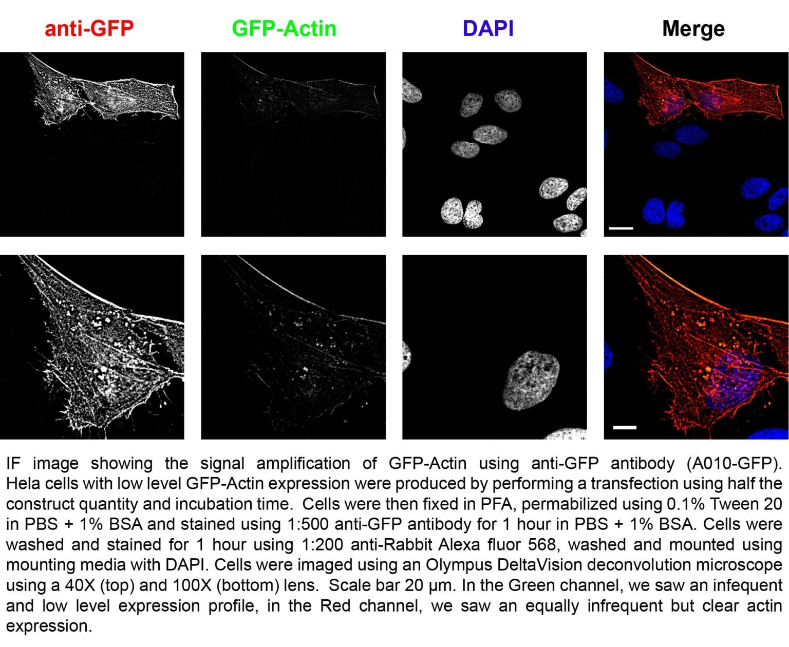 Green fluorescent protein (GFP, EGFP) pAb epitope purified - Badrilla