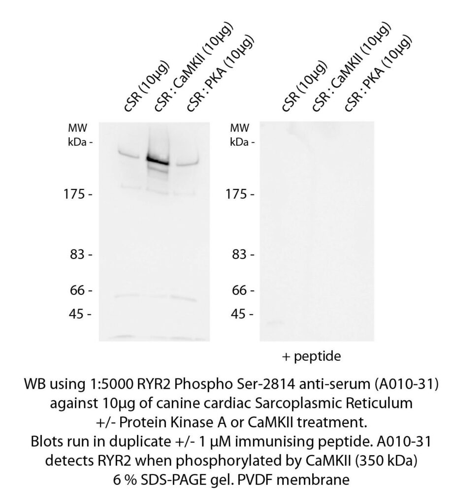 RYANODINE RECEPTOR 2 (RYR2) (pSER2814) pAB SERUM - Badrilla RYANODINE RECEPTOR 2 (RYR2) (pSER2814) pAB SERUM - Badrilla